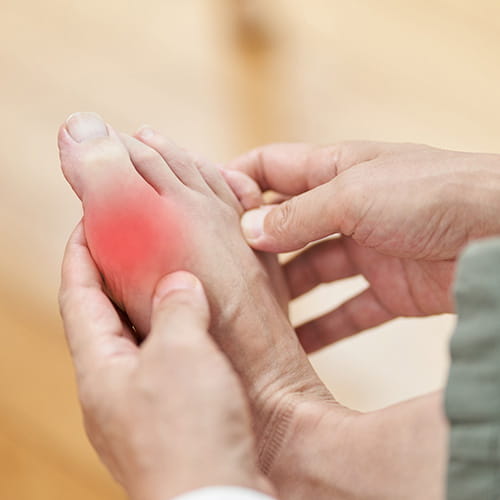 Pri-Med | Navigating the Gout Care Pathway: A...